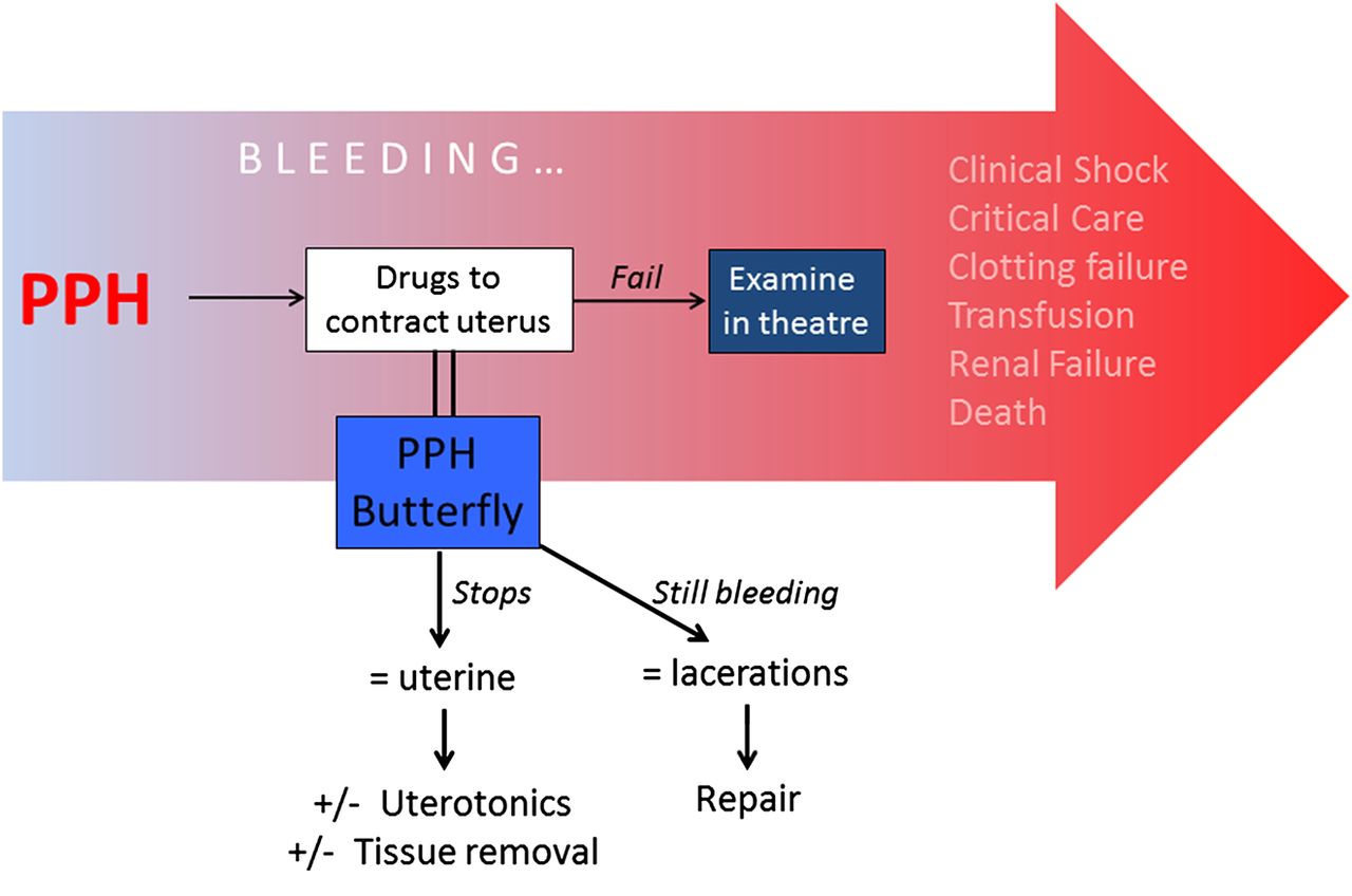 Device that could curb maternal deaths wins funding